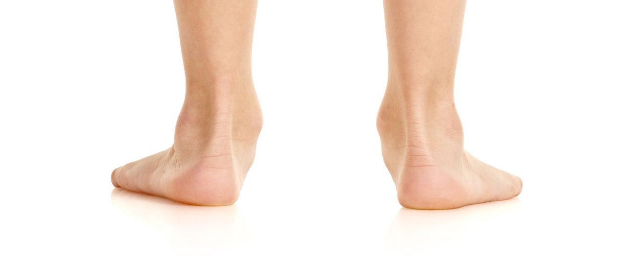 Plattfuß und Knick-Senkfuß? Trainiere diese Muskeln